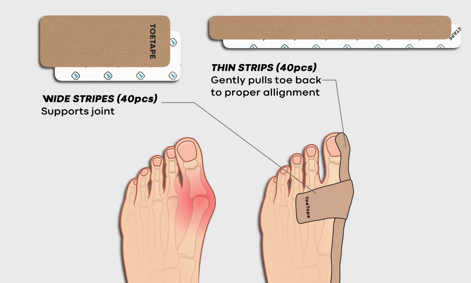 Bunion Relief Tape – ToeTape
